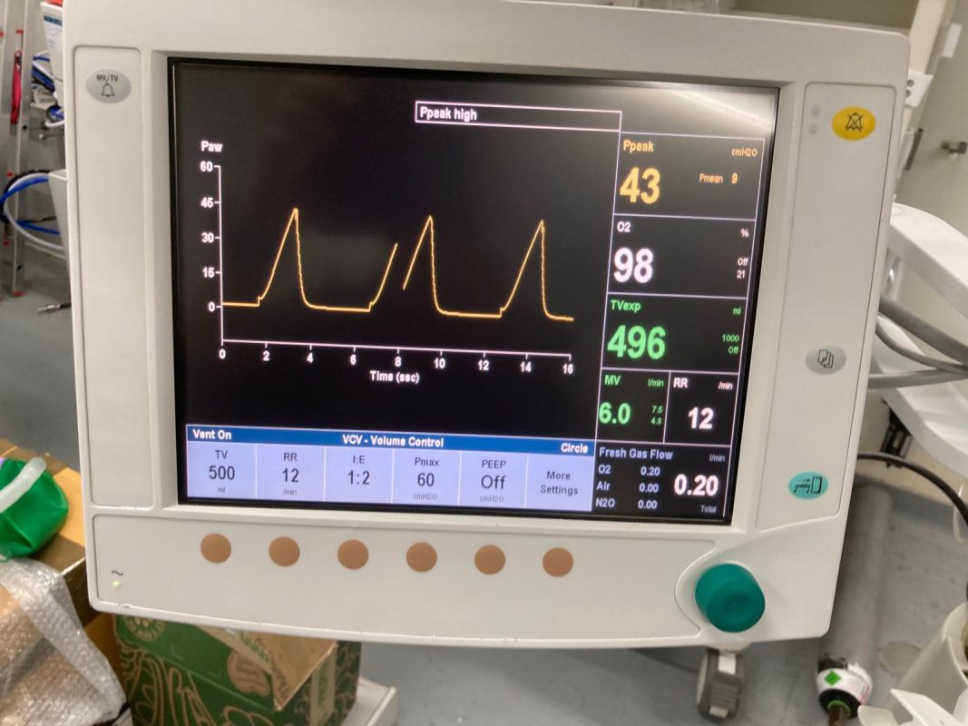 Aespire View Anaesthesia System with integrated Carescape B850 Monitor ...